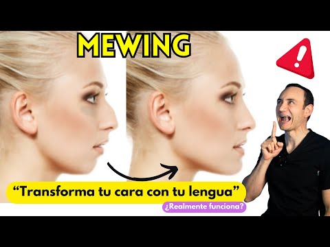 ¿Cuál es el término para hacer mewing en exceso? - Chatea y Pregunta a ...
